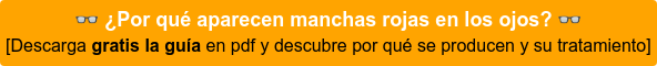 ¿Por qué a veces aparecen manchas rojas en el ojo? | Blog de Clínica ...